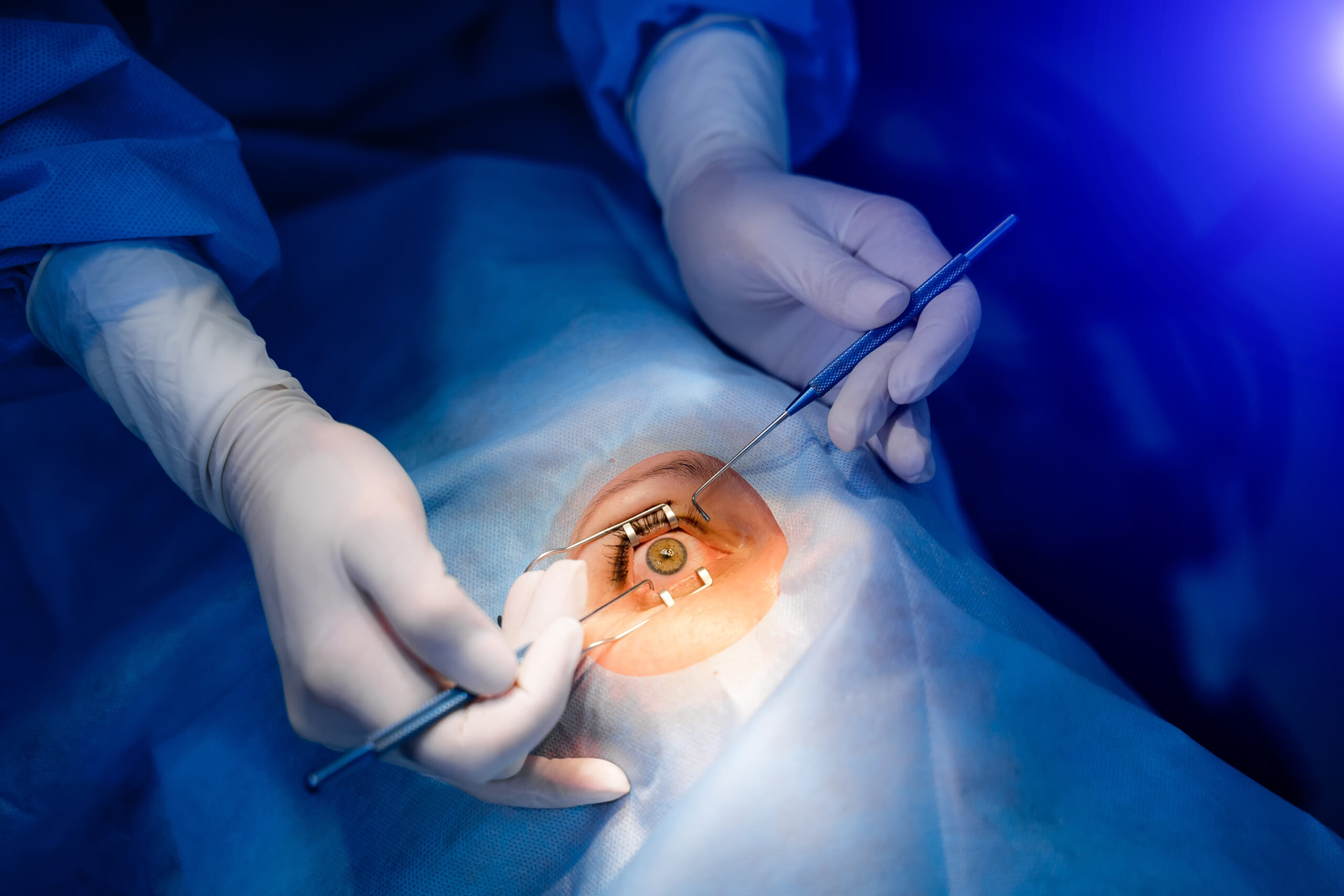 Cirurgia LASIK: Tire todas suas dúvidas sobre